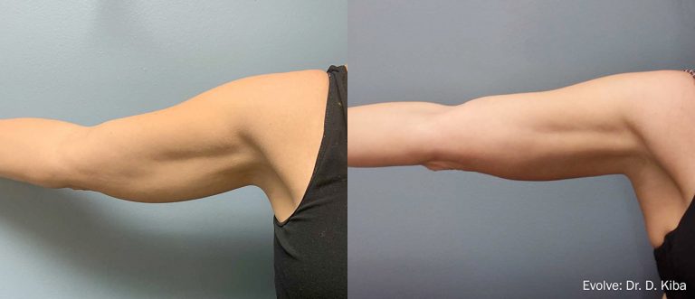 Evolve by InMode - The Dermatology Clinic